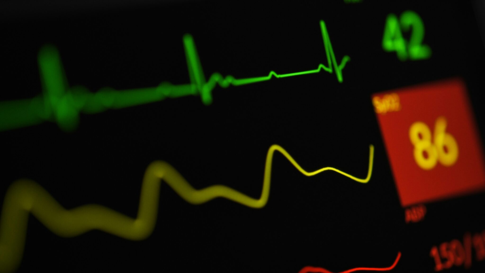 Low HRV and stress explained: The signal you should never ignore ...